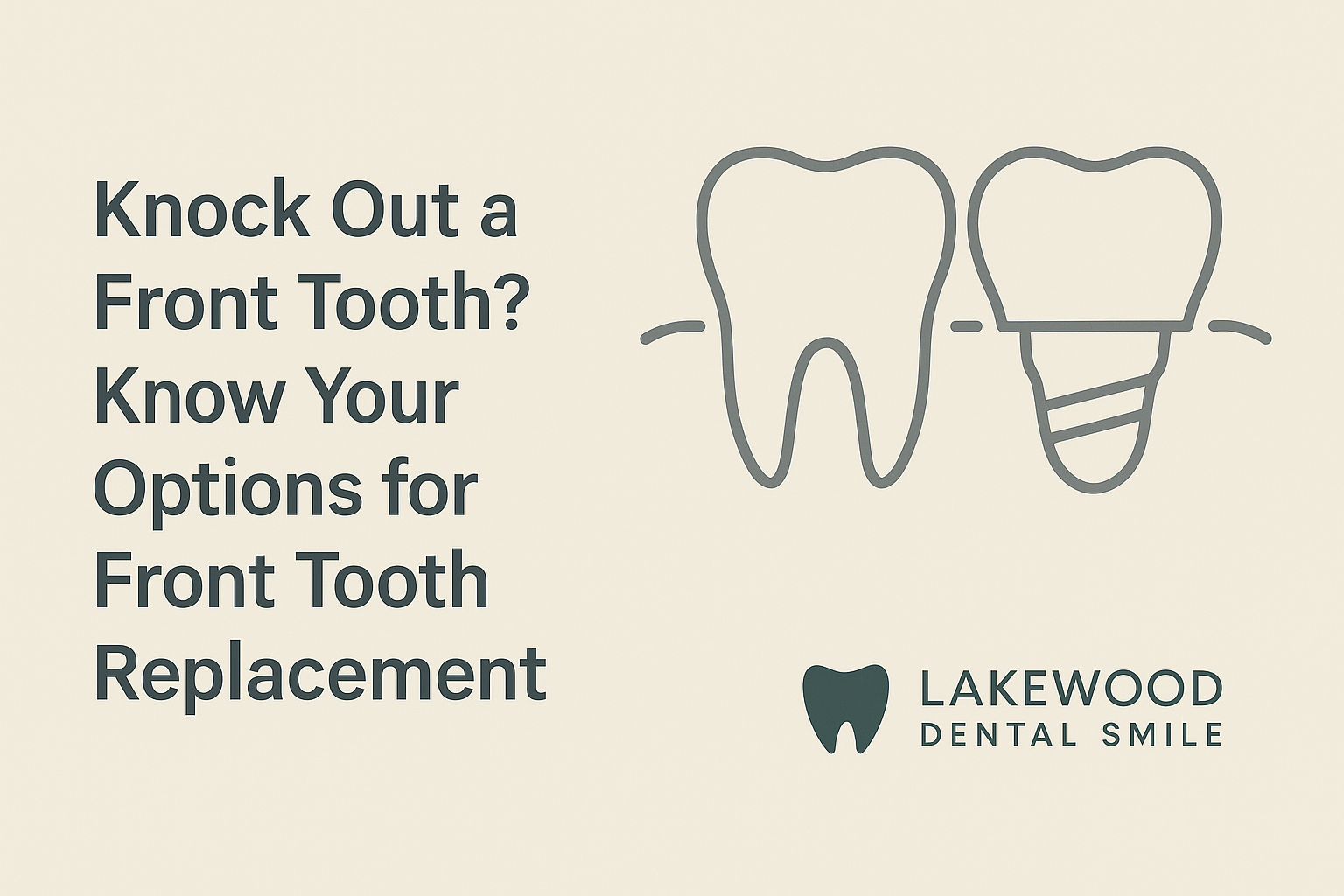 Front Tooth Replacement – 4 Best Options for Better Smiles