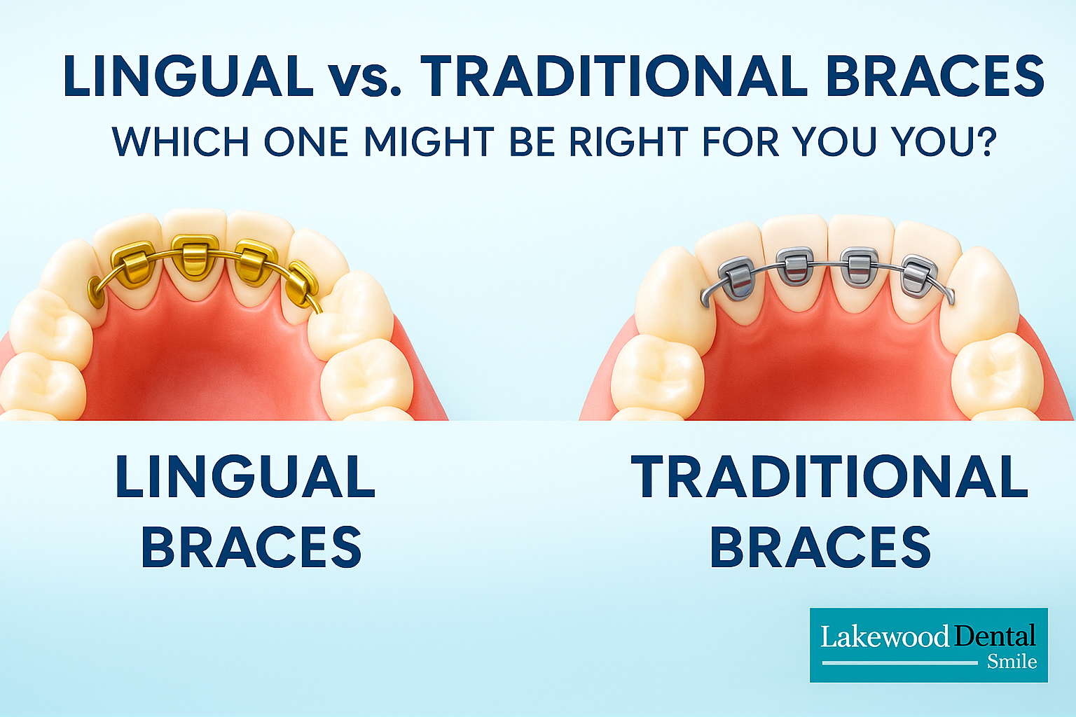 5 Expert Tips to Choose Lingual vs Traditional Braces Safely