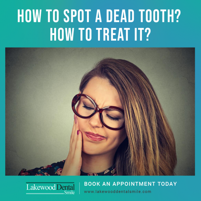 How to spot a dead tooth? How to treat it? - Lakewood Dental Smile