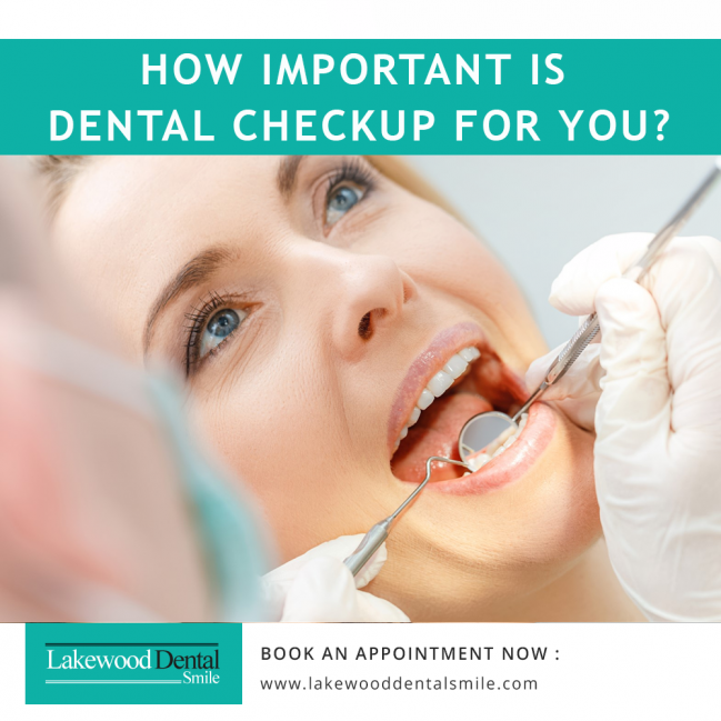 How important is dental checkup for you? - Lakewood Dental Smile