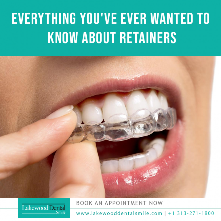 Everything You've Ever Wanted to Know About Retainers - Lakewood Dental ...